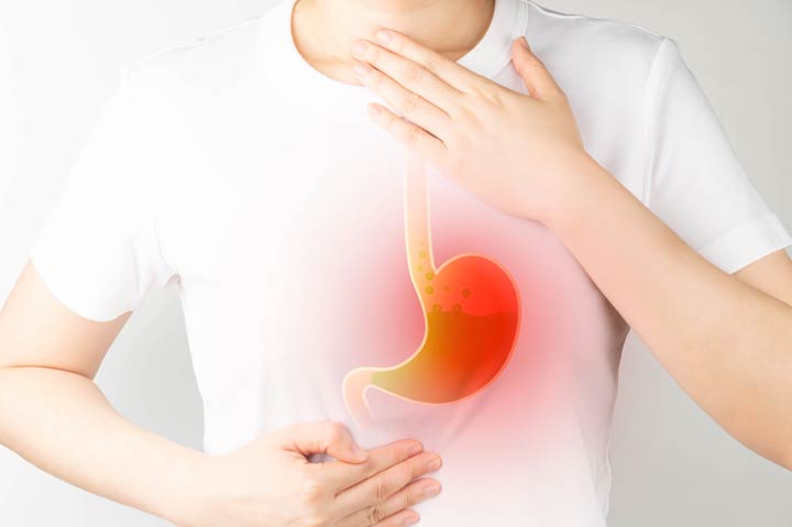 Behandlung von Reflux | Mister Wong